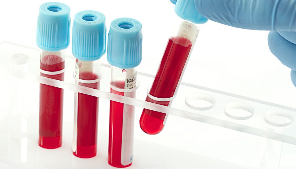 Check Up Base Plus – Laboratorio Analisi CR